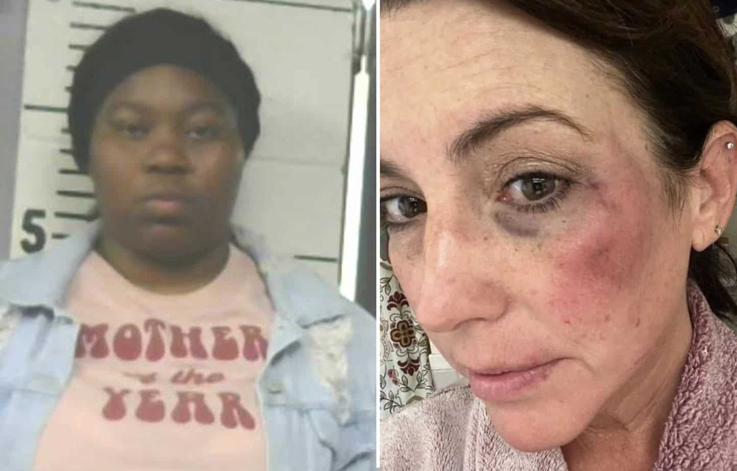 Umpire Is Punched in the Face by a ‘Mother of the Year’ Who Had Been ...